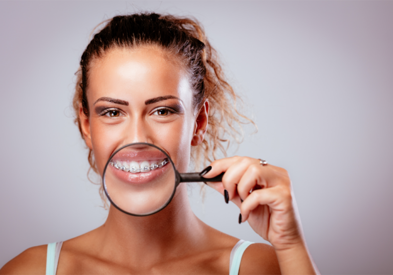 Orthodontie Montpellier Orthodontiste Centre Dentaire Montpellier